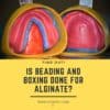 How Dentures are made step by step? - Best Cheatsheet - extooth